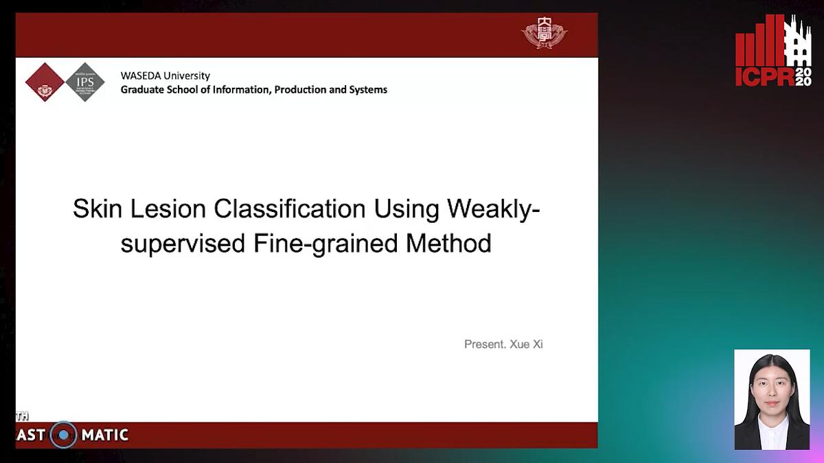 Underline | Skin Lesion Classification Using Weakly-supervised Fine-grained Method