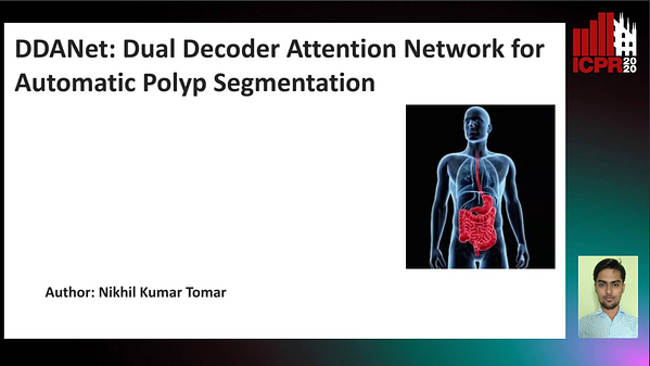 Underline Ddanet Dual Decoder Attention Network For Automatic Polyp Segmentation