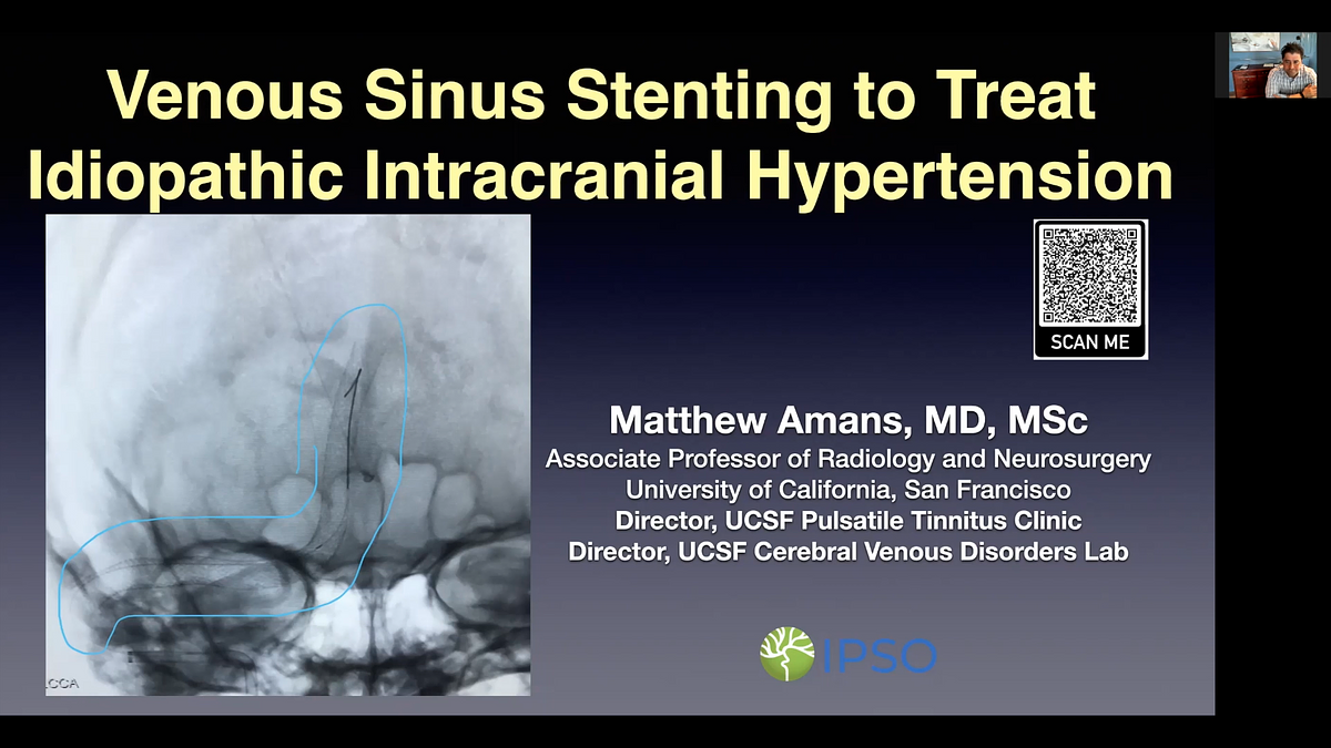 Underline | Venous Sinus Stenting to Treat Idiopathic Intracranial ...